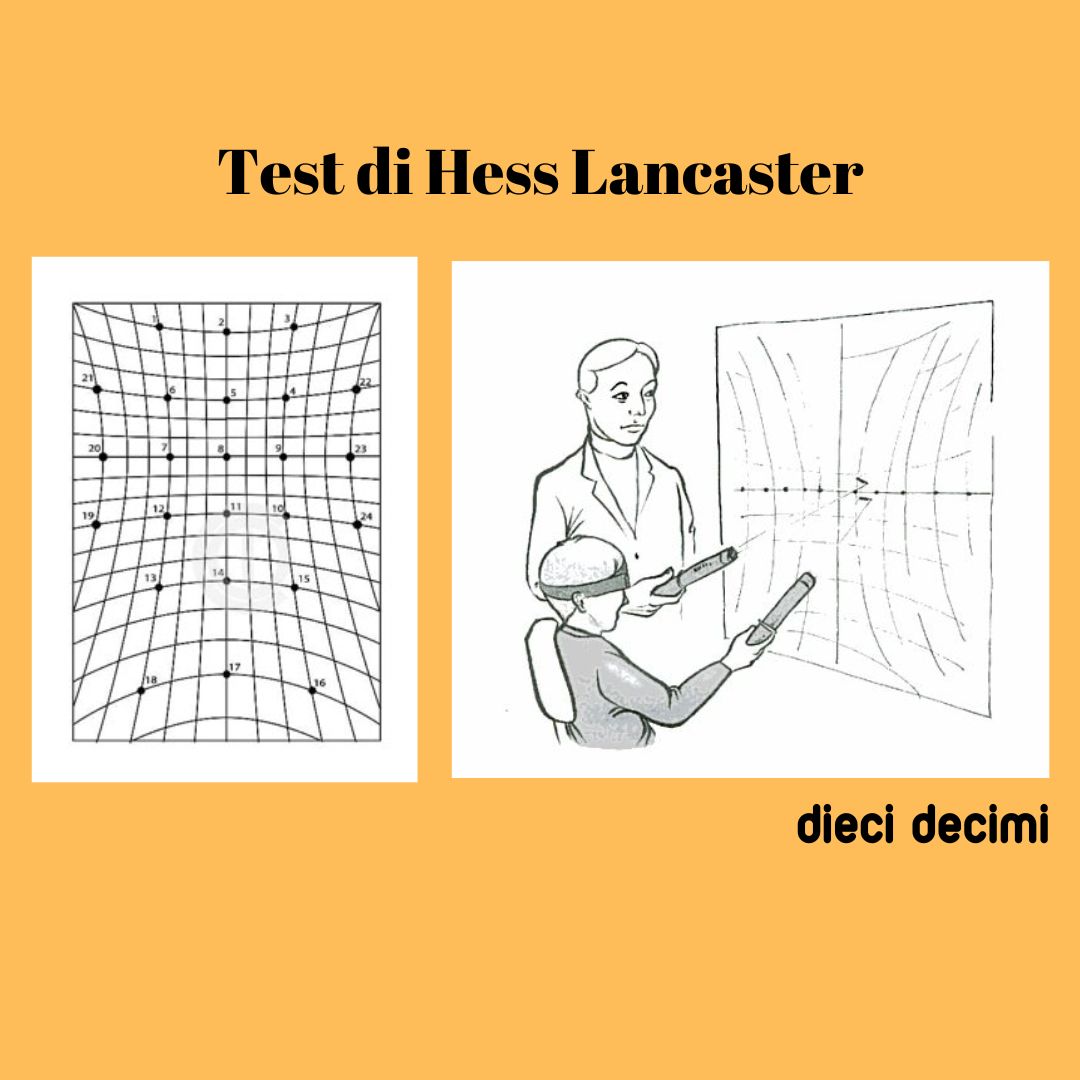 Ottica napoli dieci decimi specializzata nel test schermo di hess ...